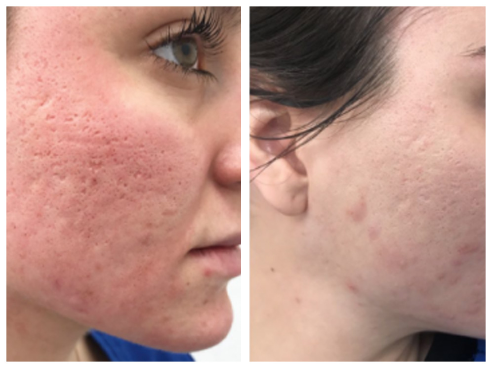 Dr Neti's Skin Hair And Nail Clinic